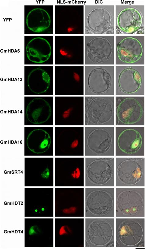 Subcellular Localization Of Gmhdacs Gmhdacs Eyfp Fusion Constructs
