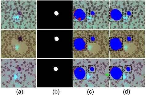 Figure 1 From Deep Features Aggregation Based Joint Segmentation Of
