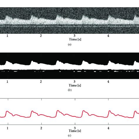 The Outputs Of The Signal Extraction Process In The Top Down View A