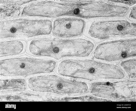 Plant Cell Under Electron Microscope