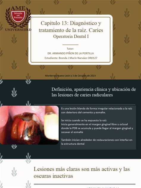 Capitulo 13 Caries Radicular Pdf Compuesto Dental Especialidades