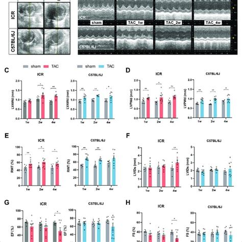 Echocardiography At 1 2 And 4 Weeks Post Tac Or Sham Surgery In Icr Download Scientific