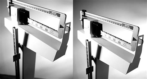 Weight Bias And Its Clinical Consequences Dialogue Cpsos