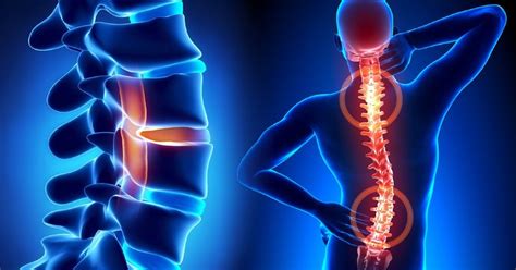 რა ემართება სხეულს როდესაც ორგანიზმში ძალიან ბევრი მარილია რჩევები ვივიენისგან