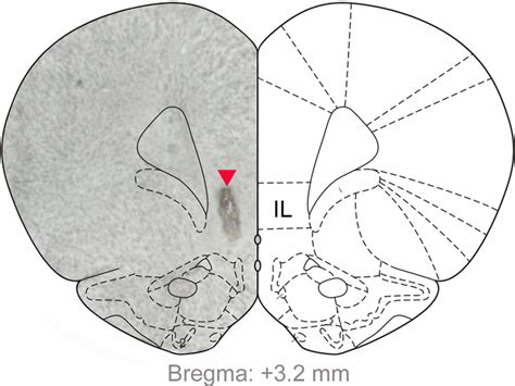 A Schematic Diagram Adapted From The Rat Brain Atlas By Paxinos And Download Scientific Diagram