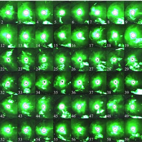 Test Results Of Yolov4 Model Showing The Ground Truth Black Ellipse
