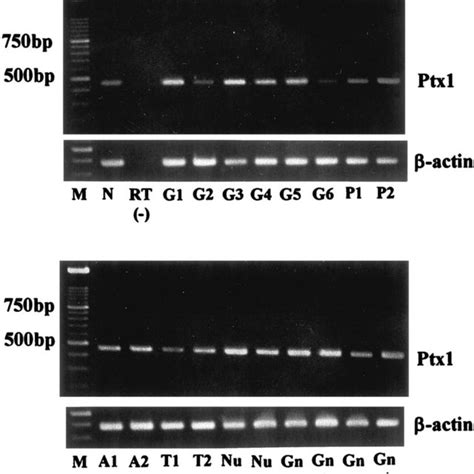 Schematic Showing Sampling For Tissue Microarray Tma Construction