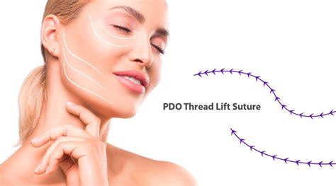 Pdo Thread Lift Sutures Application Method Indications And Benefits