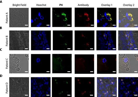 A D Fluorescence Micrographs Of Ffpe Tissue Sections Of Suspected Download Scientific Diagram