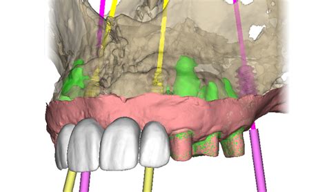 Dsd Planning Center Services For Dentists