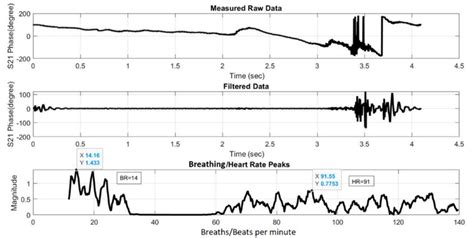 Hrbr Measurement Of Subject 1 Using Four Element Array Hr 91 Br 14