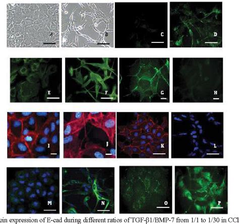Figure 1 From The Ratio Of Transforming Growth Factor β1 Bone