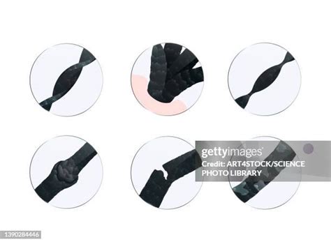 Mutation Drawing Photos And Premium High Res Pictures Getty Images