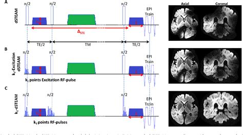 Figure 1 From Ultra High Resolution And Multi Shell Diffusion Mri Of Intact Ex Vivo Human Brains