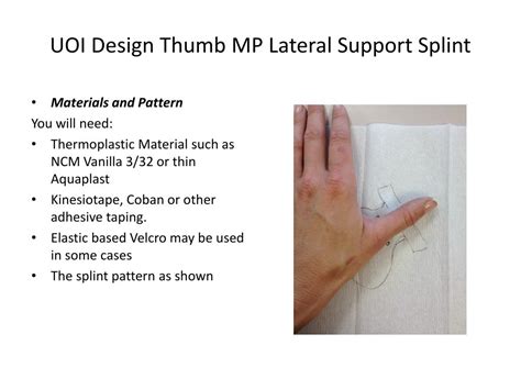 Ppt Innovative Splinting Options For The Thumb Mp Joint Powerpoint