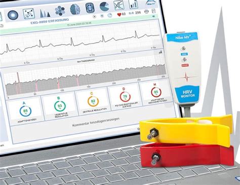 Nilas Herzratenvariabilitätsmessung Mit Therapie Günter Kasper Naturheilpraxis Und Coaching