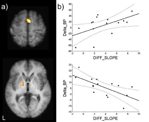 Results Of The Correlation Analyses Between Behavioral And Imaging