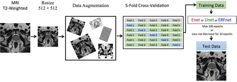 Figure 1 From Deep Learning Based Methods For Prostate Segmentation In Magnetic Resonance