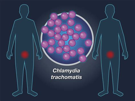 Doxycycline For Chlamydia