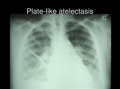 Ppt Respiratory System Powerpoint Presentation Free Download Id177440