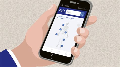 Cervical Subaxial Facet Injuries Evaluation Management And How To