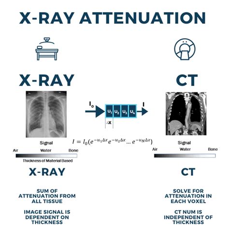 Attenuation Xray At Rina Parra Blog