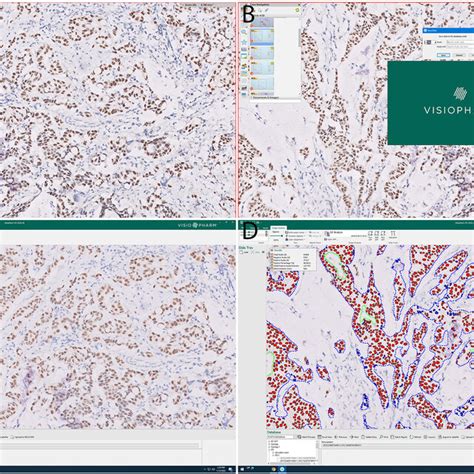 Automated Workflow Of Er Ihc Digital Imaging Analysis Dia Using Download Scientific Diagram
