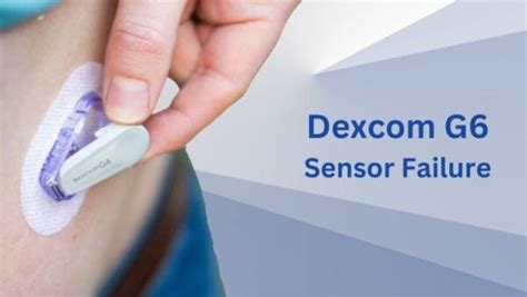 Dexcom G Sensor Failure A Comprehensive Analysis