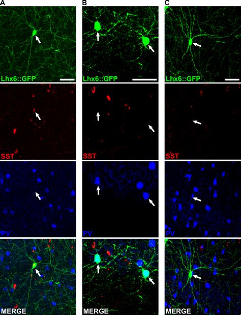 Differentiation Of Mouse Embryonic Stem Cells Into Cortical Interneuron Precursors