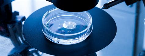 Donor Sperm Insemination Conditions And Treatments Ucsf Health