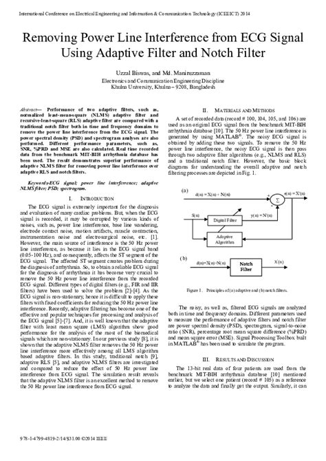 Removing Power Line Interference From Ecg Signal Using Adaptive Filter
