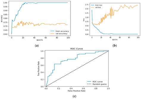 Electroencephalography Based Depression Detection Using Multiple Machine Learning Techniques