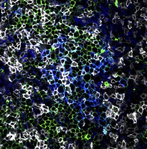 Lung Tissue Forms Immune Cell Hubs When Needed The Roslin Institute