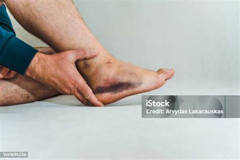 발목을 삐고 부어 오른다 남자는 집에서 삔 발목을 잡고 있습니다 발목 염좌 부상흰색 회색 배경 복사 공간 건강관리와 의술에 대한 스톡 사진 및 기타 이미지 Istock