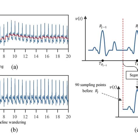 Raw Ecg Heartbeat Signal And Cwt Scalogram Subfigures Ab Represent