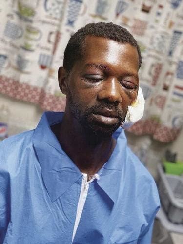 Assault Charges Against Pd Dismissed News
