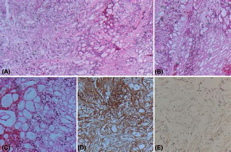 Pathology Specimens A H And E At 4x Demonstrating Multiphasic Download Scientific Diagram