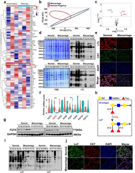 Mest 的 α1 3 岩藻糖基化通过激活翻译起始促进细胞滋养层细胞的侵袭潜力 Cell Death And Disease X Mol