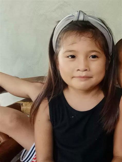 Girl 9 Recovering After Scissors Were Stuck In Her Head For A Week