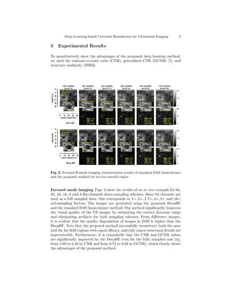 Deep Learning Based Universal Beamformer For Ultrasound Imaging Deepai