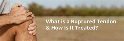 What Is A Ruptured Tendon And How Is It Treated South Florida