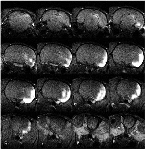 Manganese Enhanced Mri Of Rat Brain With A Permanent Middle Cerebral