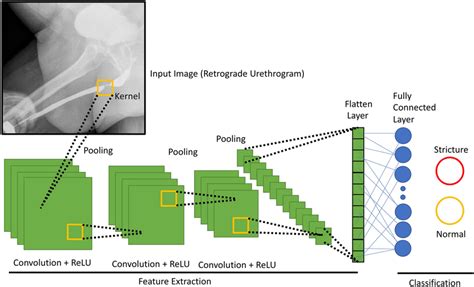 a brief summary of model development process—an input image undergoes