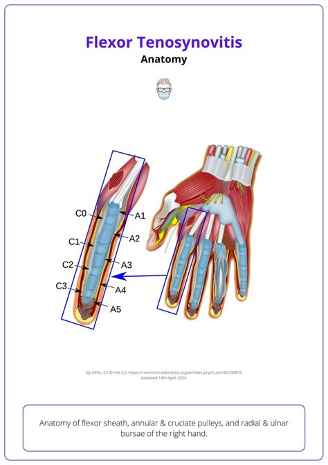 Pyogenic Flexor Tenosynovitis Anatomy Clinical View And Treatment