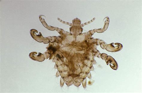 海虱子百科 海虱子 伤感说说吧