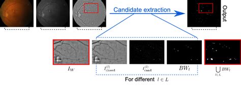 Red Lesion Candidate Detection See Section 21 For A Detailed