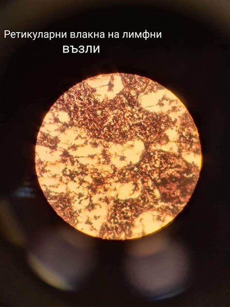Ретикуларна съединителна тъкан слезка
