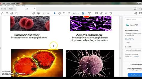 Gram Negative Cocci In Clusters