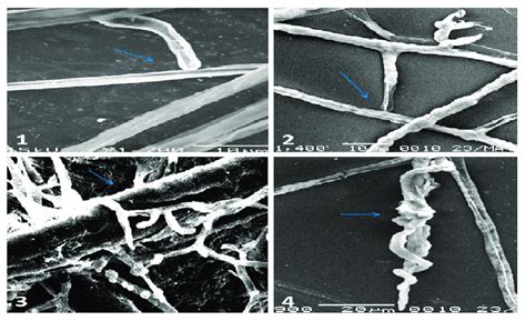 Hyphal Interactions Between P Oligandrum Ms 15 And P Download Scientific Diagram
