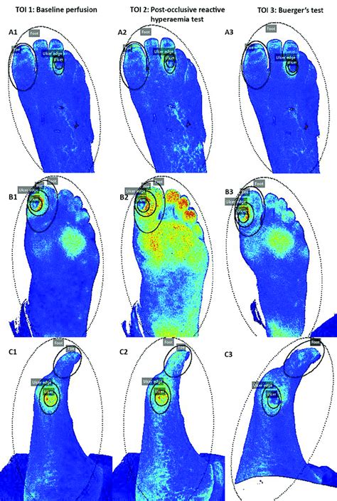 Roi Tracking During Baseline Measurement Left Post Occlusive Download Scientific Diagram